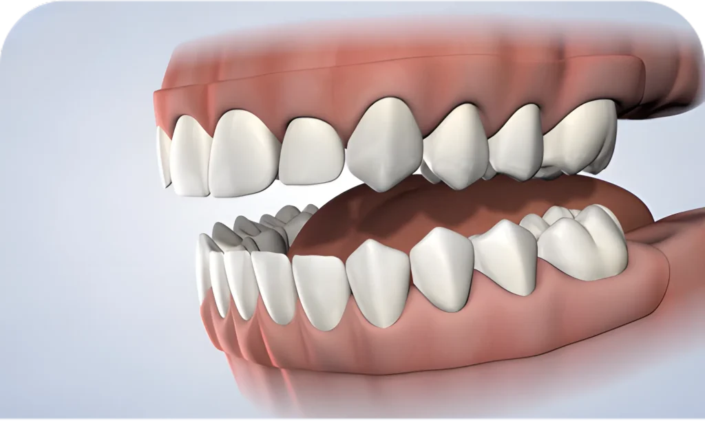 Pre-Prosthetic Surgery in Amarillo, TX